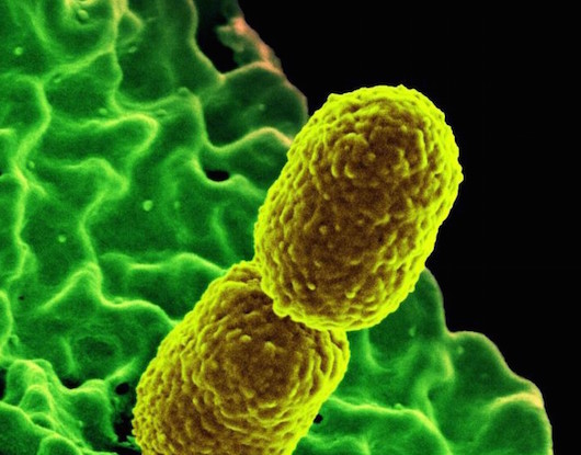 These 12 Superbugs Pose The Greatest Threat To Human Health, WHO Says ...